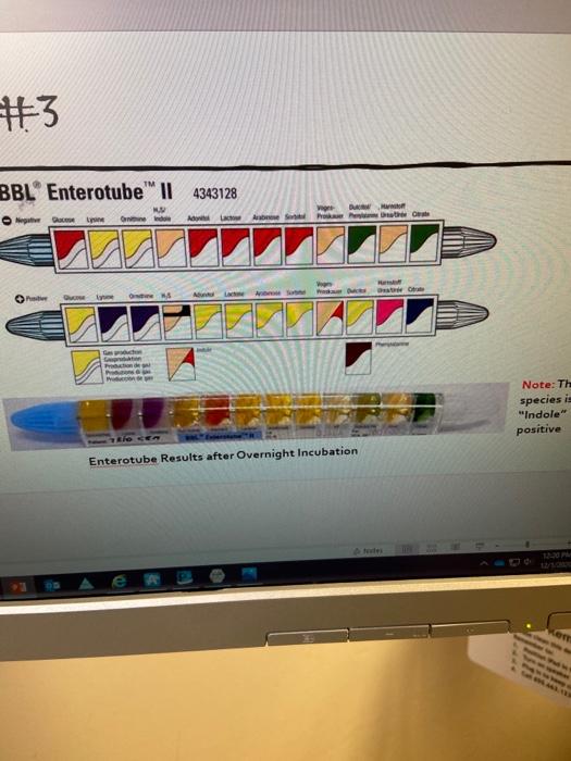 Solved #3 BBL Enterotube™ || 4343128 DAM Pre Orde Mehr | Chegg.com