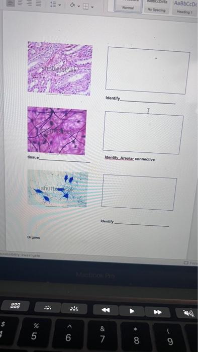 Lab Activity Chapter 4 Identify the tissues in the | Chegg.com