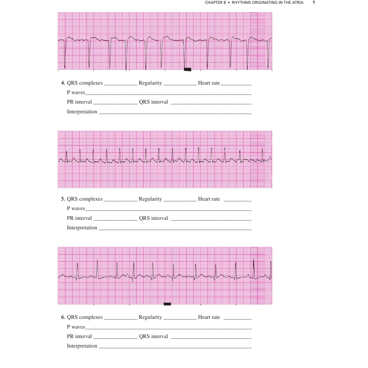 CHAPTER 8 - ﻿RHYTHMS ORIGINATING IN THE ATRIA14. ﻿QRS | Chegg.com