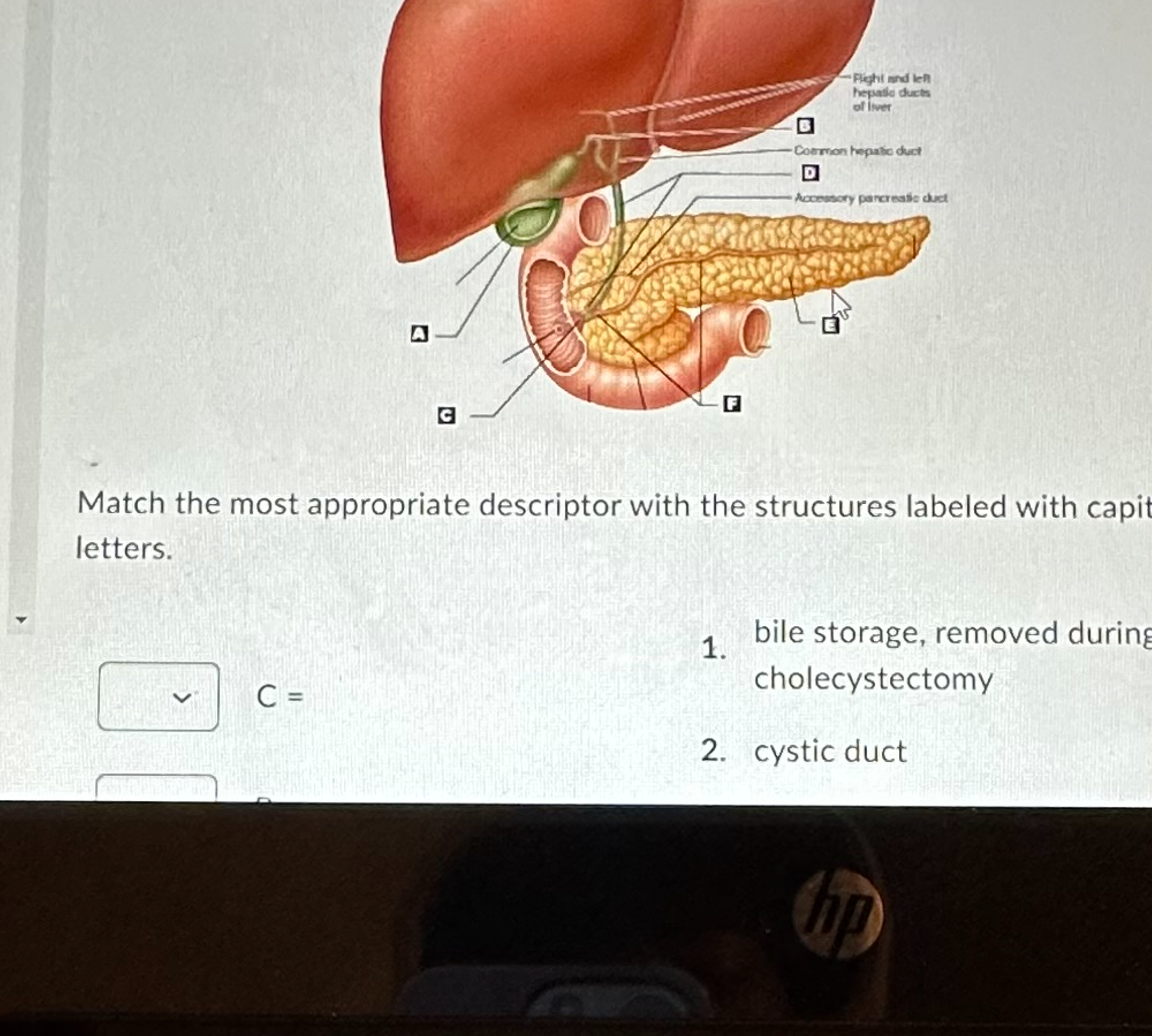 Solved bile storage, removed during cholecystectomy2. | Chegg.com