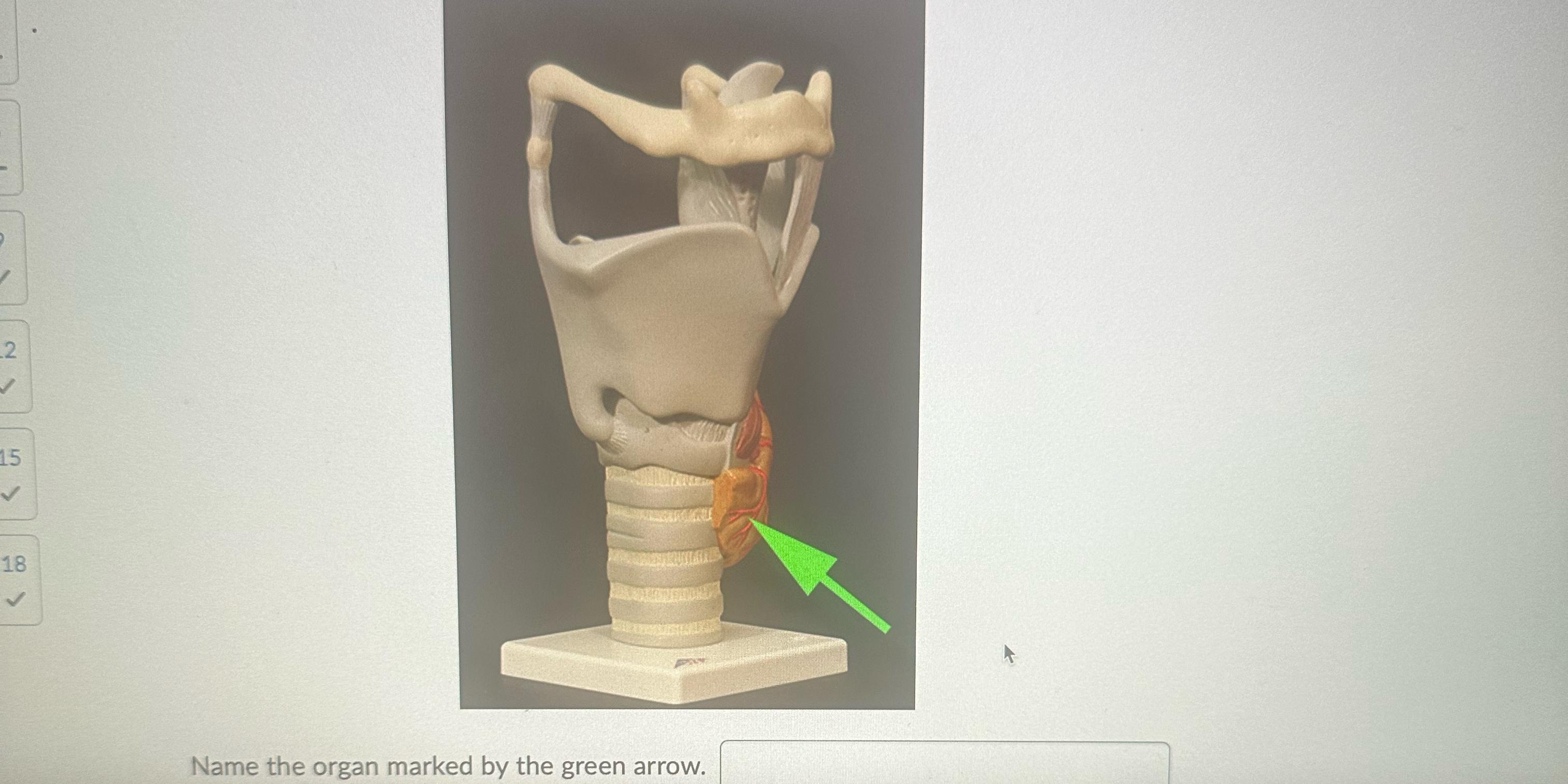 Solved Name the organ marked by the green arrow | Chegg.com