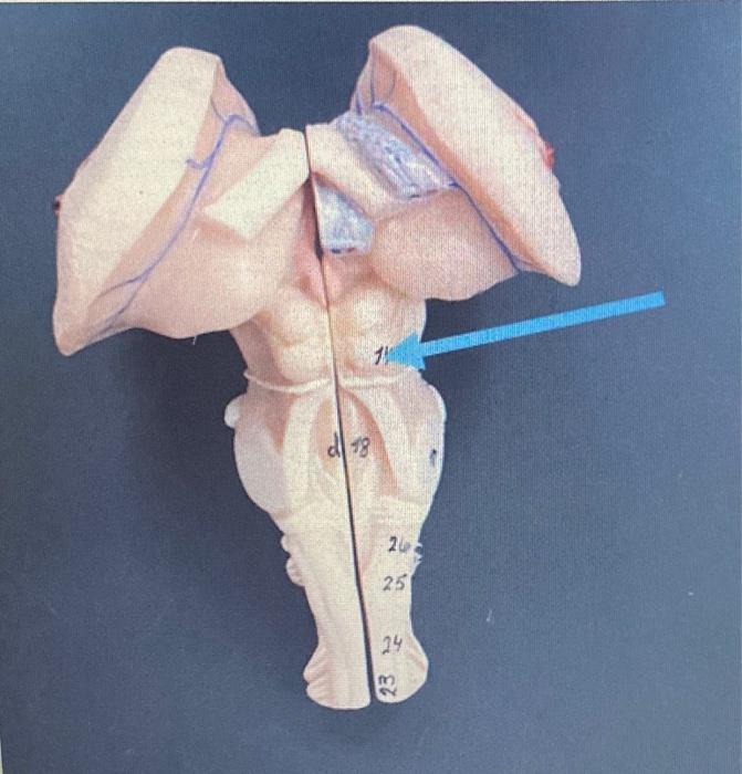 Solved identify the structure at the end of the arrow | Chegg.com