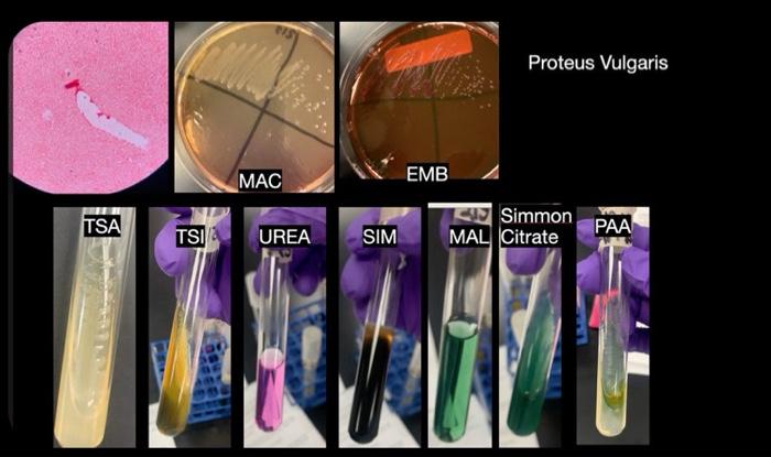 Solved unknown lab report proteus Vulgaris please answer the | Chegg.com