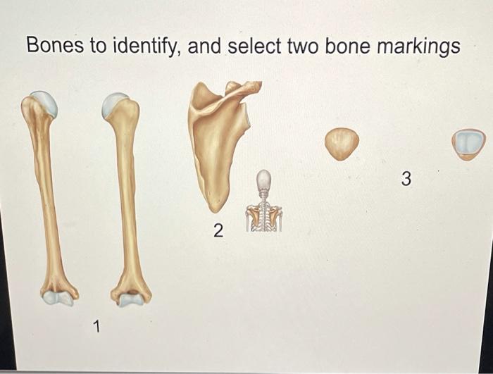 Solved Name and classify the bones according to shape. | Chegg.com