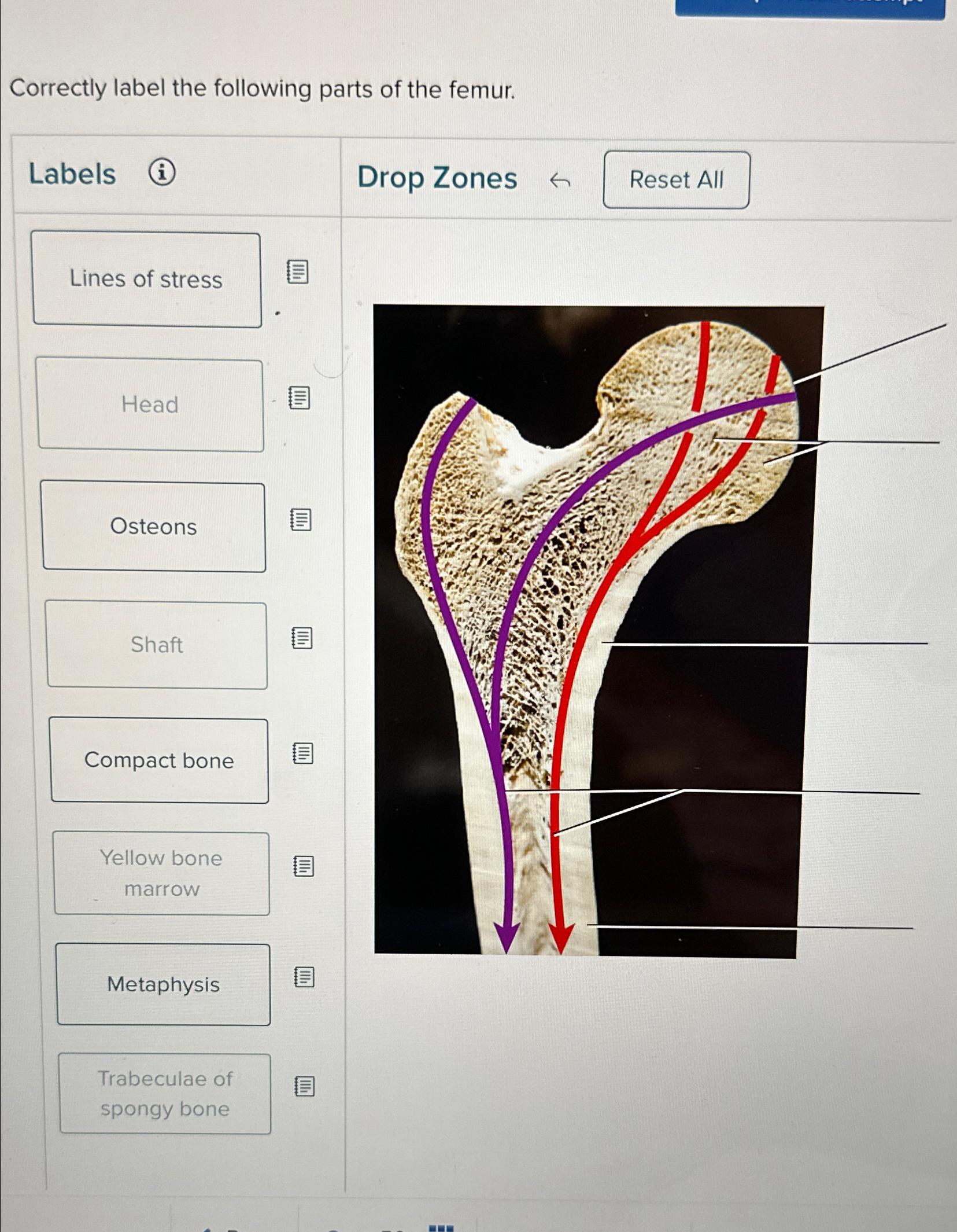 Solved Correctly label the following parts of the | Chegg.com