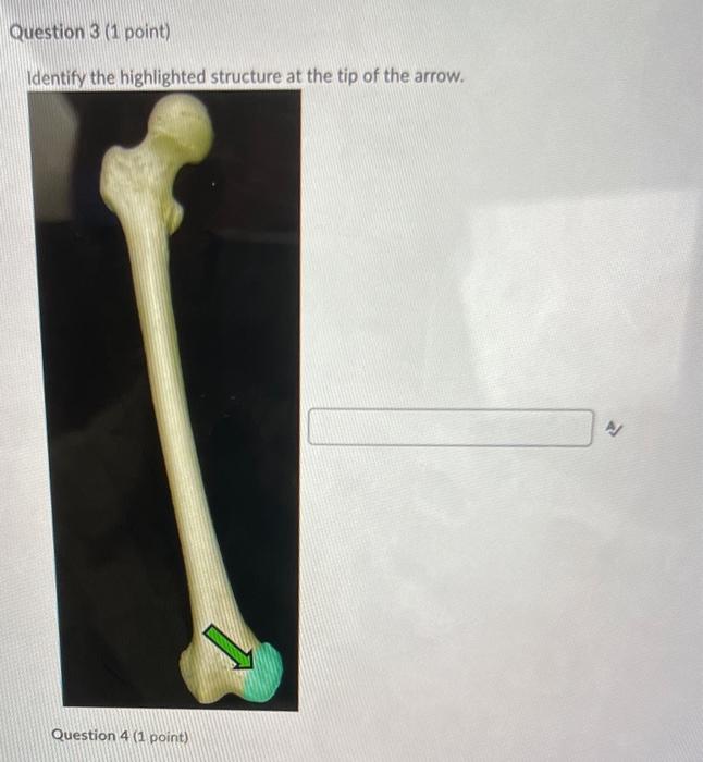 [Solved]: Identify the highlighted structure at the tip of