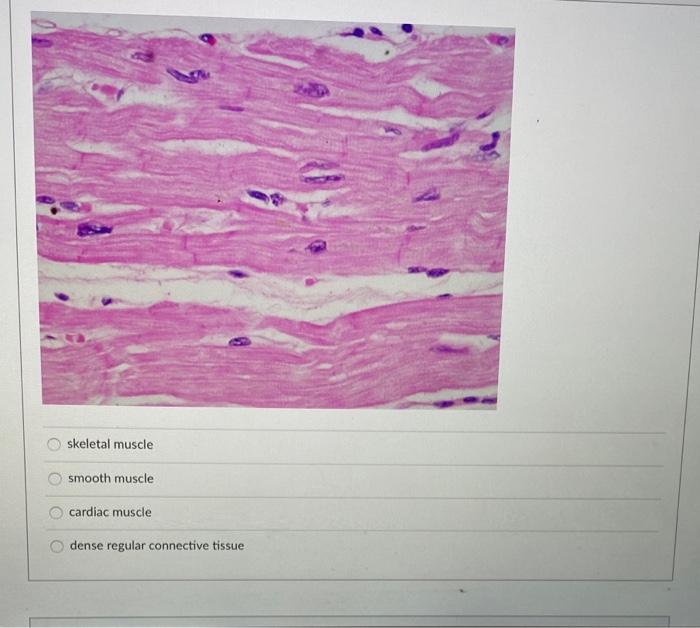 Solved skeletal muscle smooth muscle cardiac muscle dense | Chegg.com