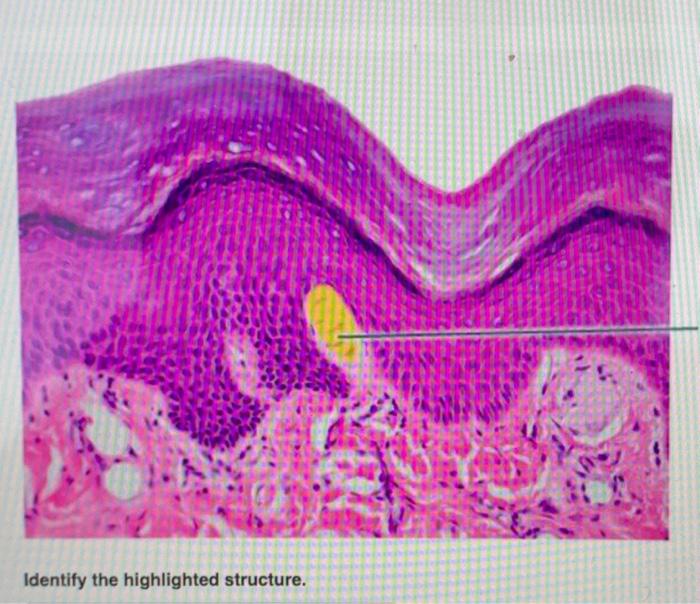 Solved Identify the highlighted structure. | Chegg.com