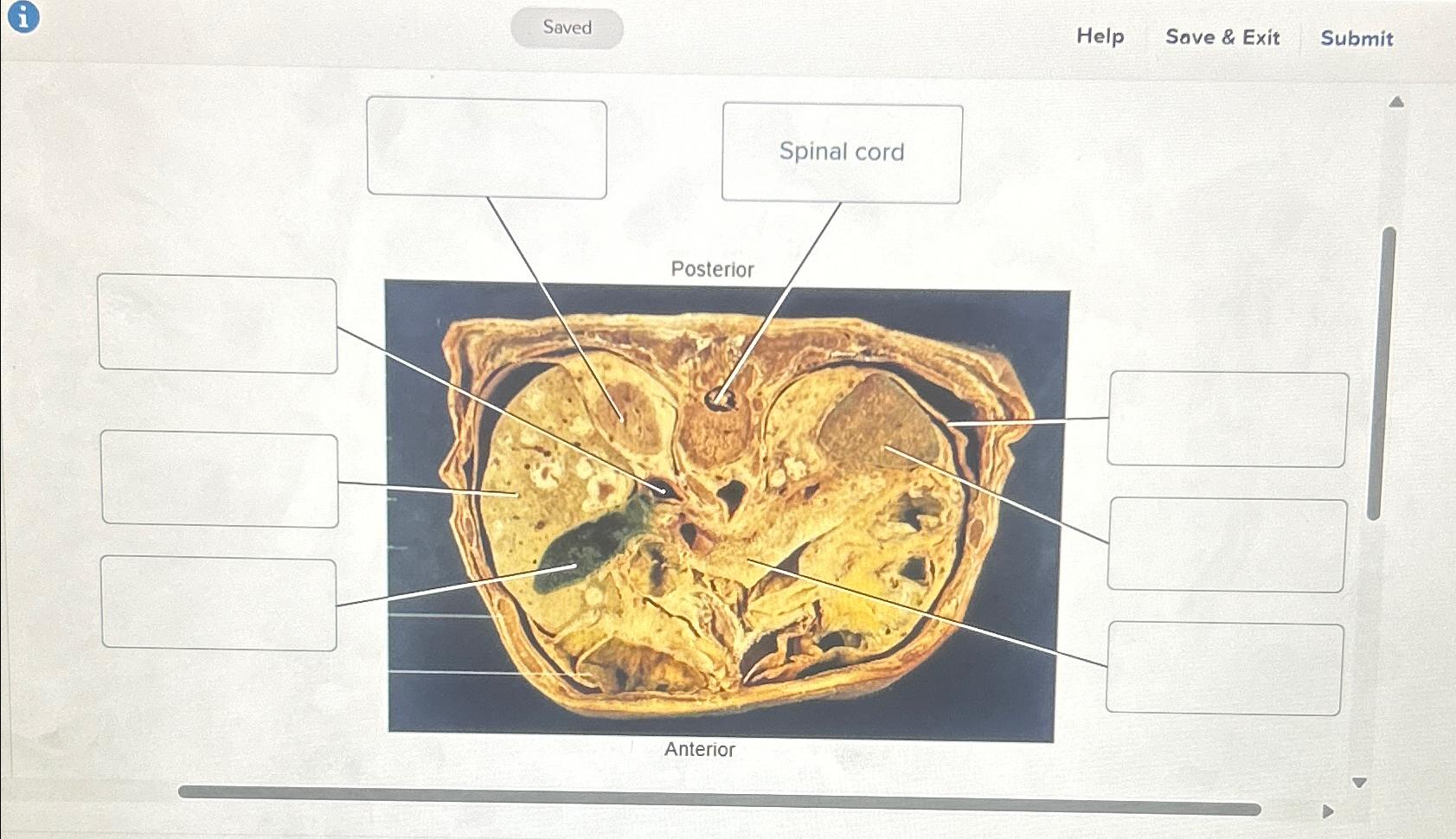 Solved (i)SavedHelpSave & ExitSubmit Labeling the transverse | Chegg.com