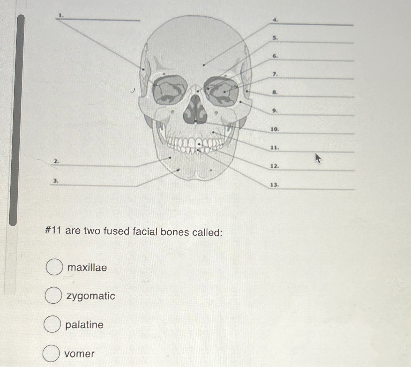 Solved #11 ﻿are two fused facial bones | Chegg.com