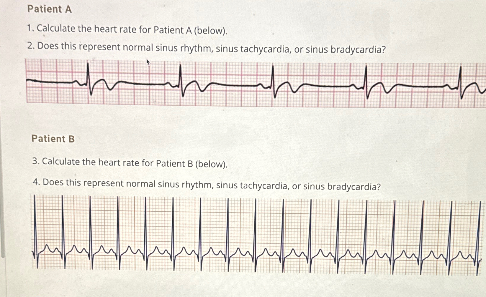 Solved Patient ACalculate the heart rate for Patient | Chegg.com