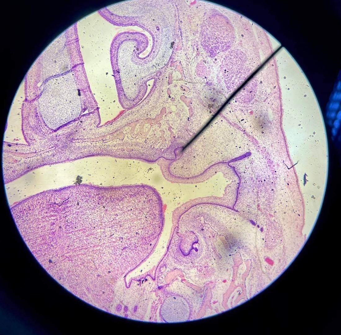 label the bud stafe of tooth development a. oral | Chegg.com