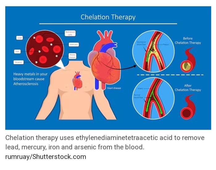Chelation therapy uses ethylenediaminetetraacetic | Chegg.com