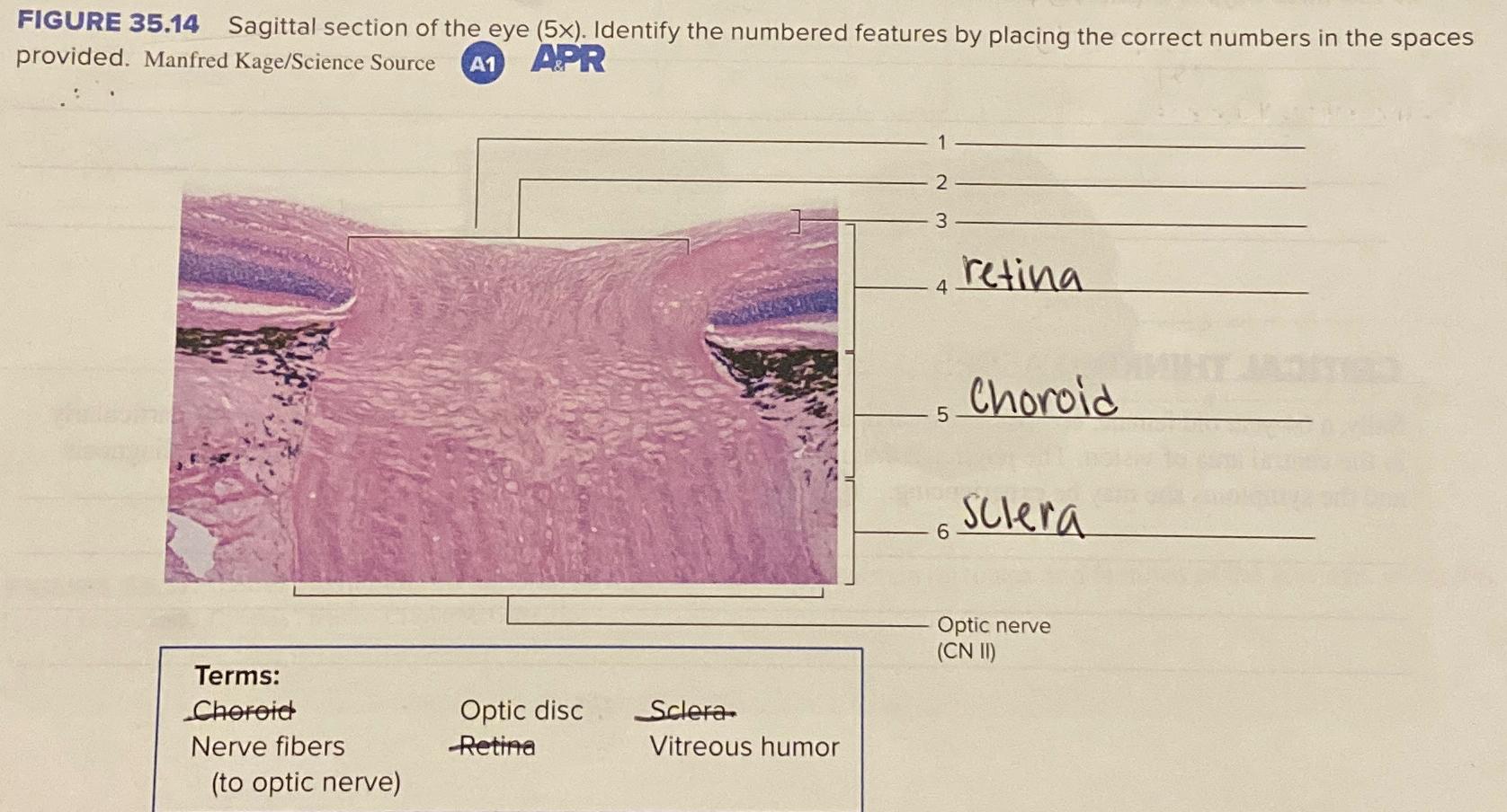 Solved FIGURE 35.14 ﻿Sagittal section of the eye (5x). | Chegg.com