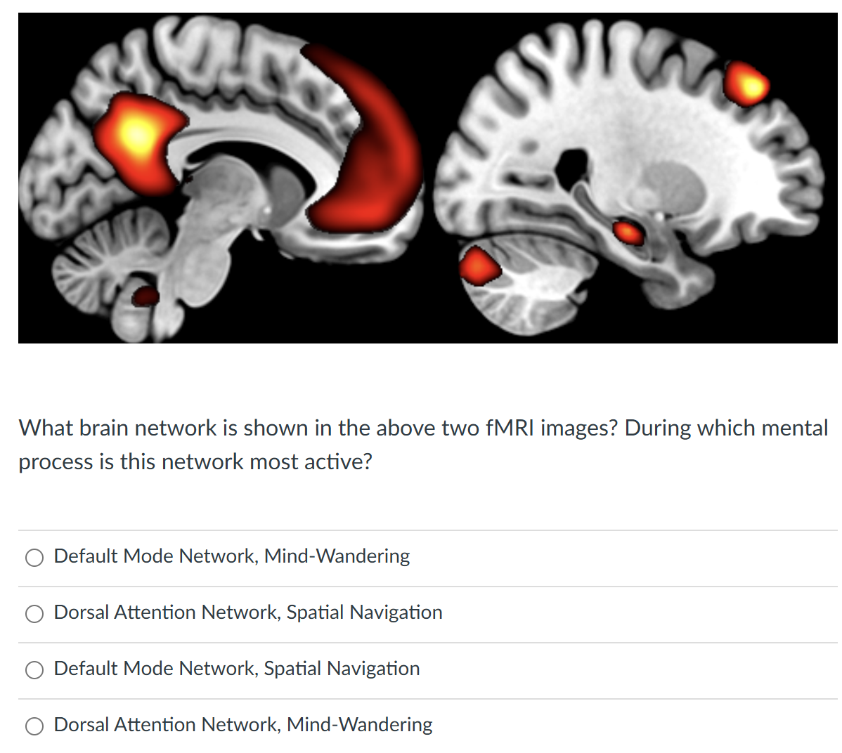 Solved What brain network is shown in the above two fMRI | Chegg.com