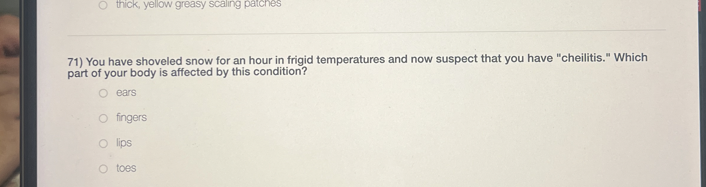Solved thick, yellow greasy scaling patchesYou have shoveled | Chegg.com