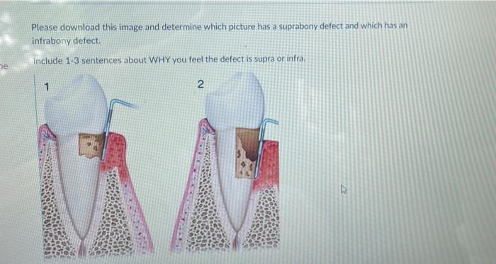 Solved Please download this image and determine which | Chegg.com