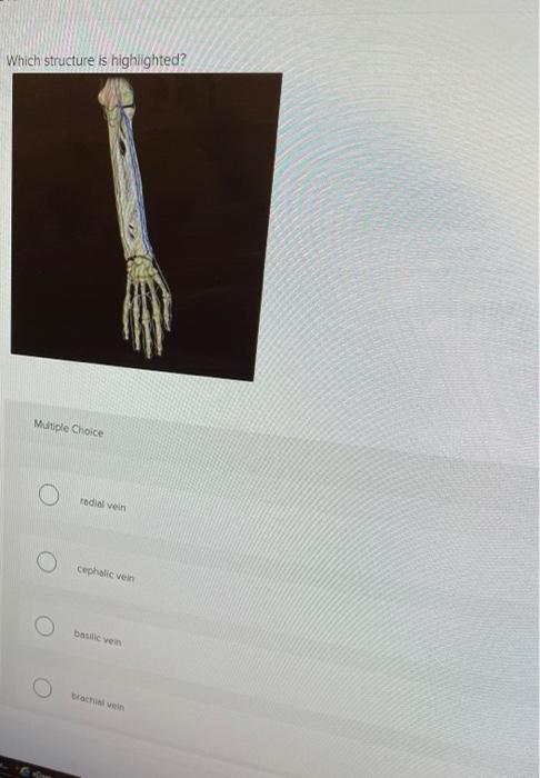 Solved Which structure is highlighted? Multiple Choice O | Chegg.com