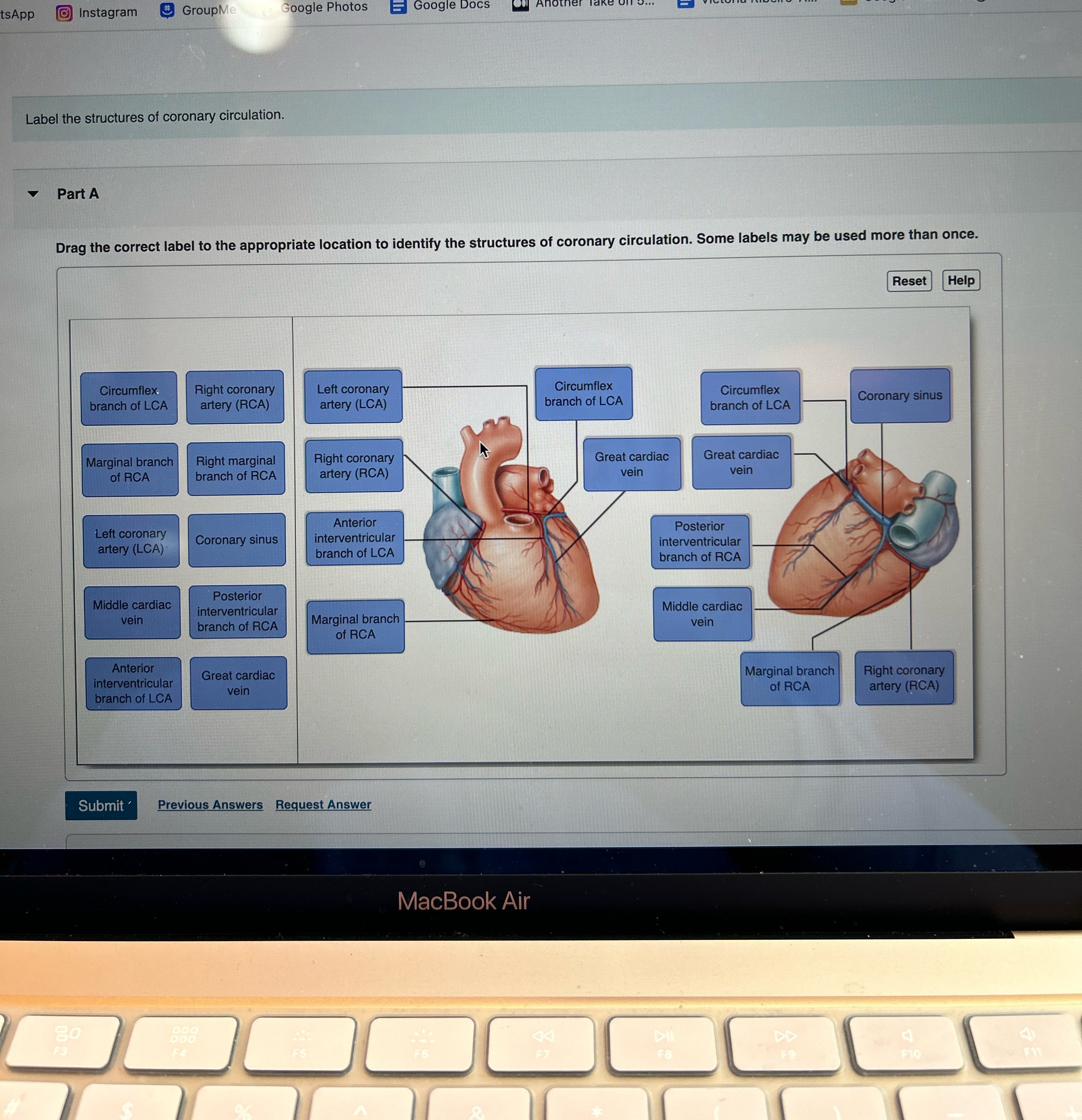 Solved Label the structures of coronary circulation.Part | Chegg.com