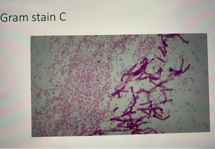 Solved What can be said about this Gram stain results? Mixed | Chegg.com
