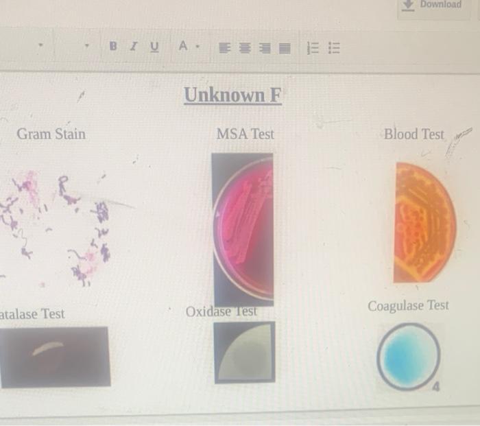 Solved 12 steps for Identification of Unknown "Bacteria" Lab | Chegg.com