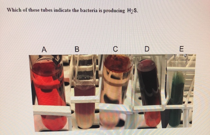 Solved Which of these tubes indicate the bacteria is | Chegg.com