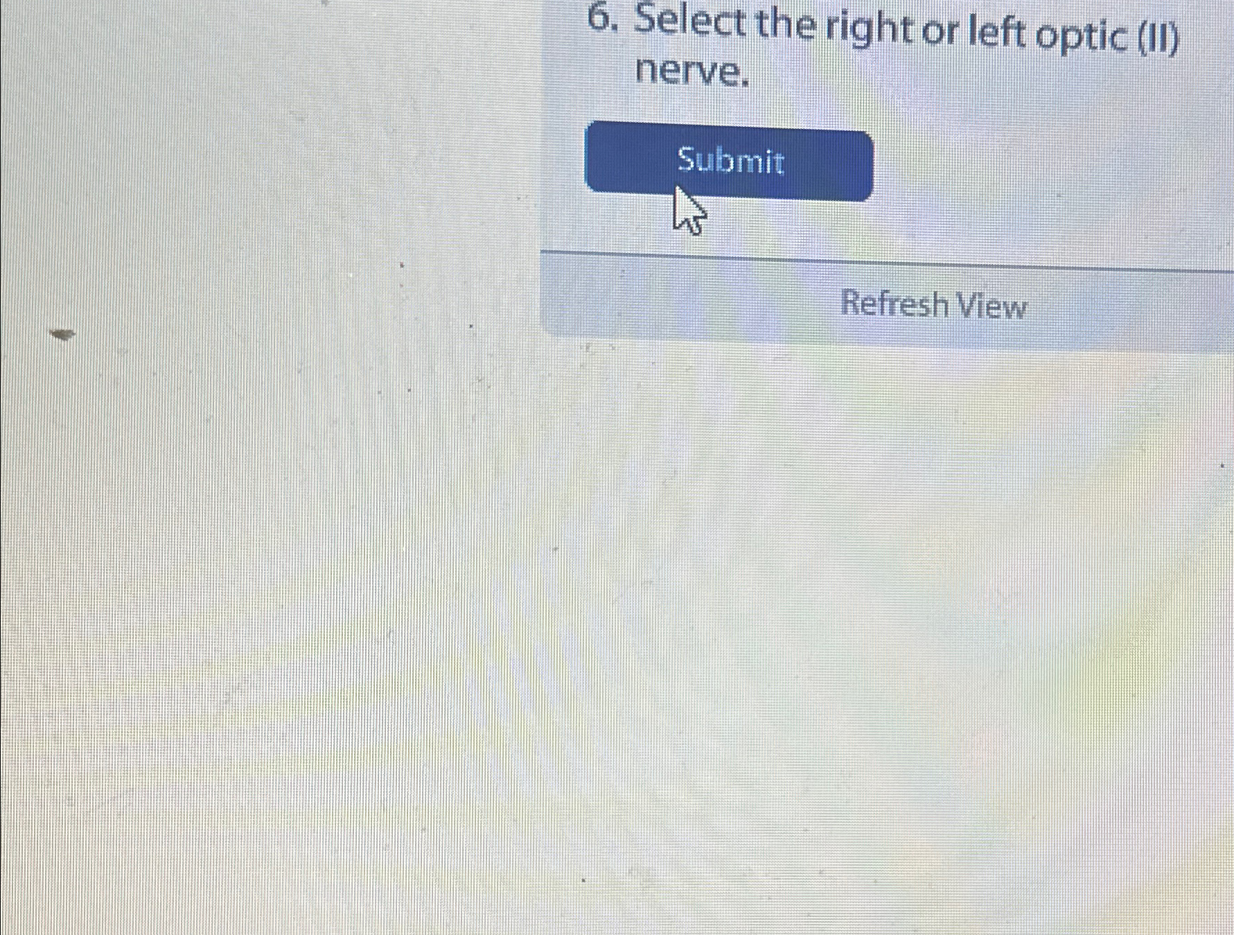 Solved Select the right or left optic (II) | Chegg.com