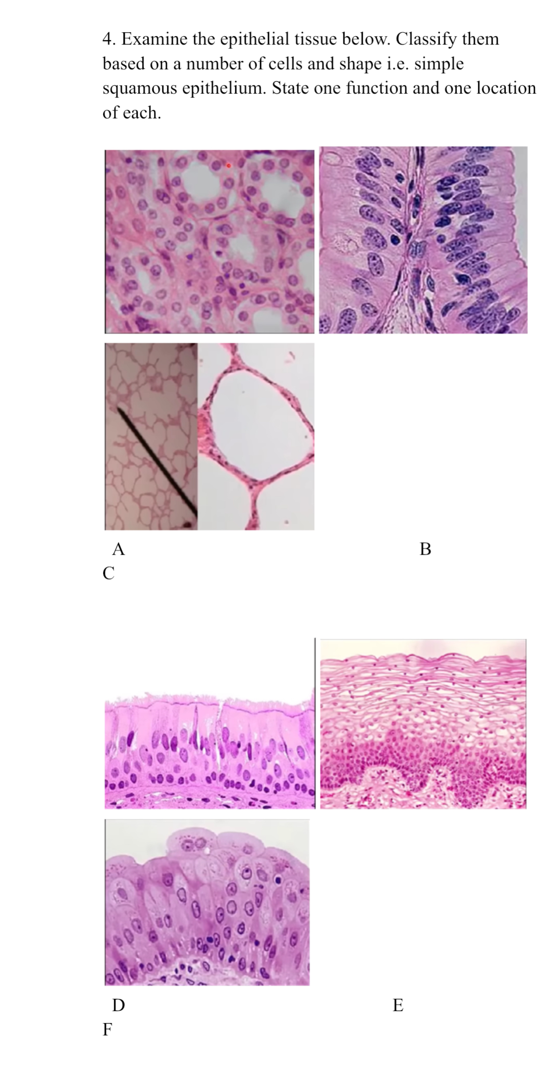 Solved Examine the epithelial tissue below. Classify them | Chegg.com