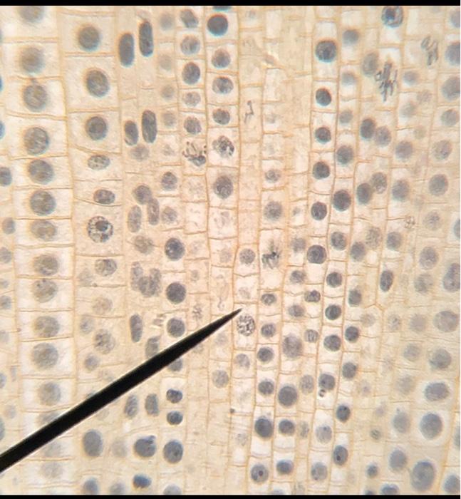Solved please count the amount of cells in interphase and | Chegg.com