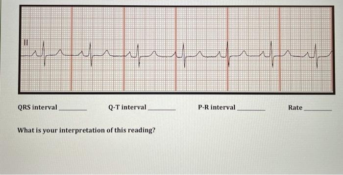 Solved | || السلالم المال pe QRS interval Q-T interval P-R | Chegg.com