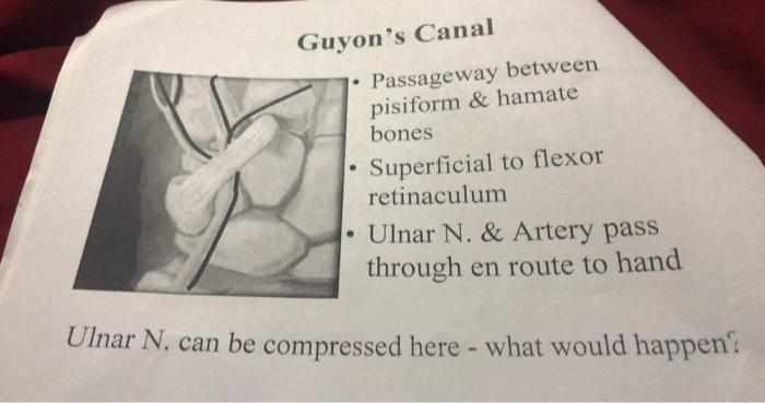 Solved Guyon's Canal 1. Passageway between pisiform & hamate | Chegg.com