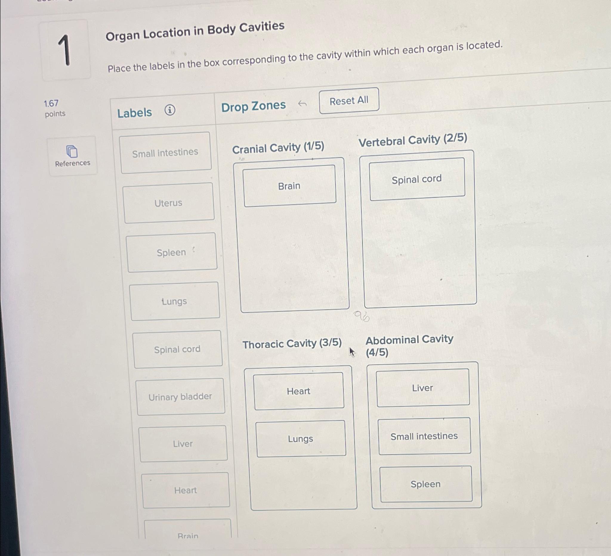 1 ﻿Organ Location in Body CavitiesPlace the labels in | Chegg.com