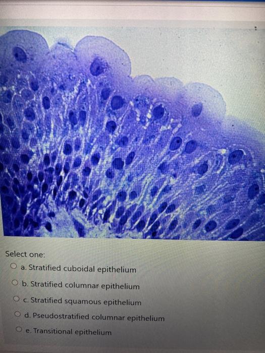 Solved Select one: a. Simple cuboidal epithelium O b. | Chegg.com