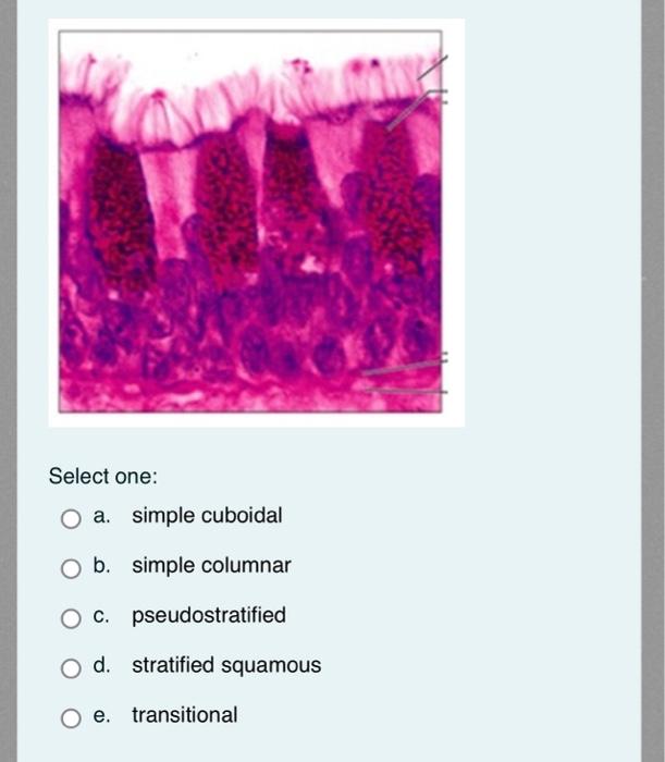 Solved Select one: a. simple cuboidal b. simple columnar c. | Chegg.com