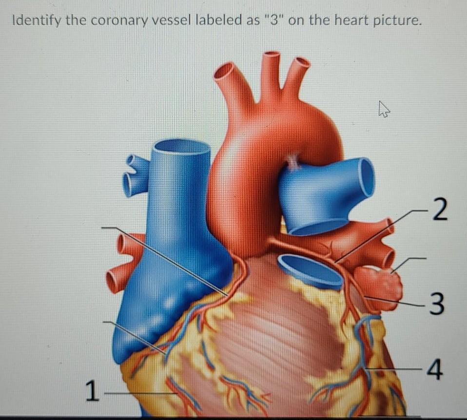 Solved Identify the coronary vessel labeled as "3" on the | Chegg.com