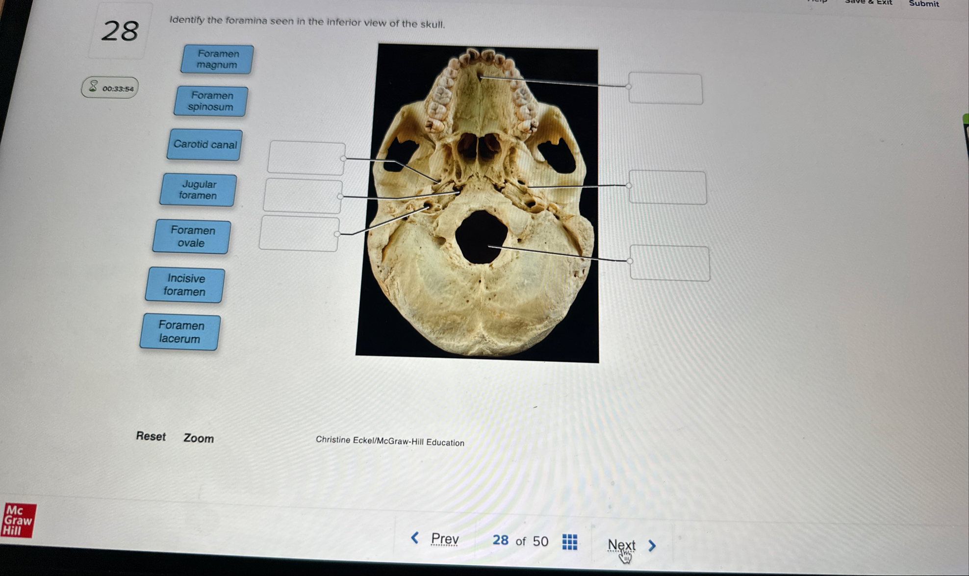 Solved Identify the foramina seen in the inferior view of | Chegg.com
