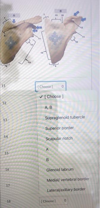 15 16 11 [Choose . [Choose ] 12 А, В Supraglenoid | Chegg.com