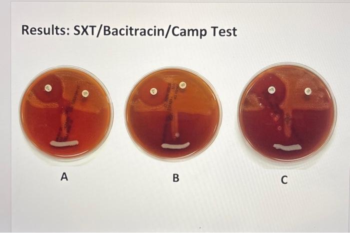 Solved Results: 6.5%NaClResults: Bile EsculinResults: | Chegg.com