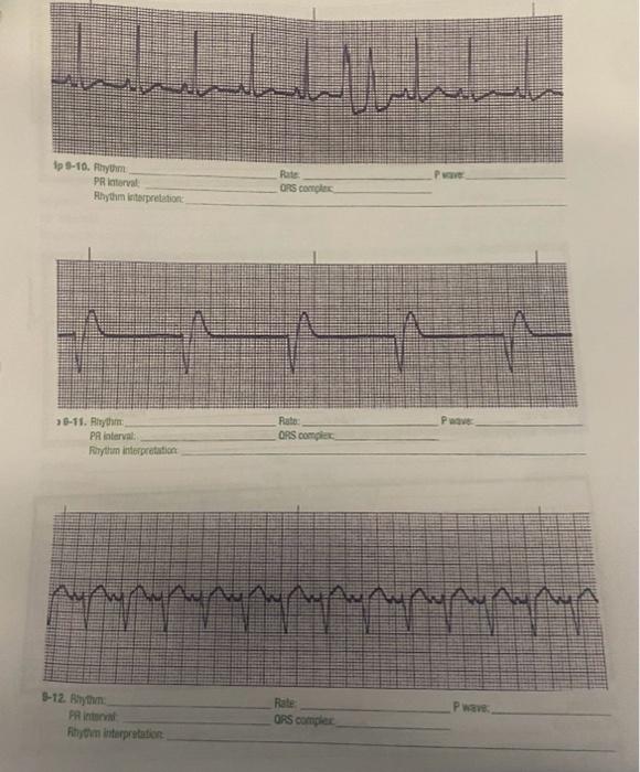 Solved Rhythm: Rate: PR Interval: a.s Complex: Rhythm | Chegg.com