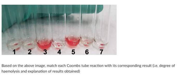 Solved 1 2 3 4 5 6 7 Based on the above image, match each | Chegg.com