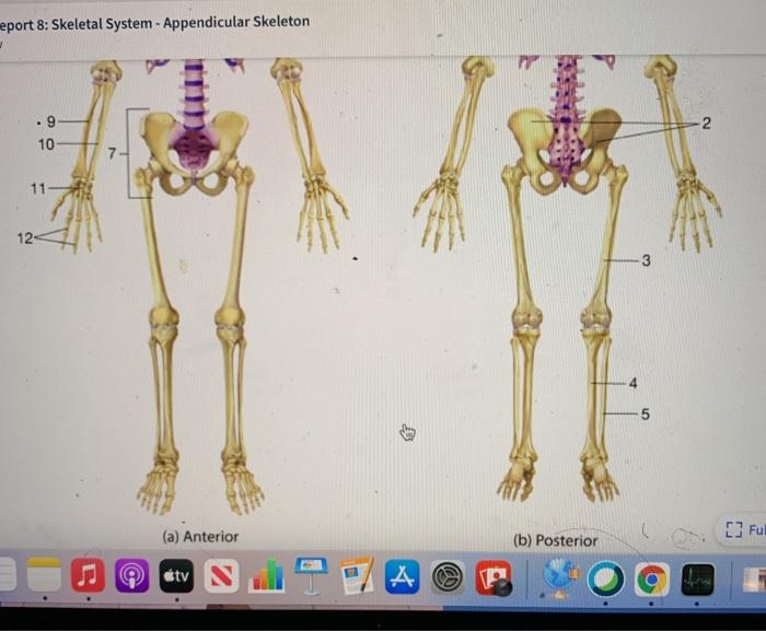 Solved Lab Report 8: Skeletal System - Appendicular Skeleton | Chegg.com