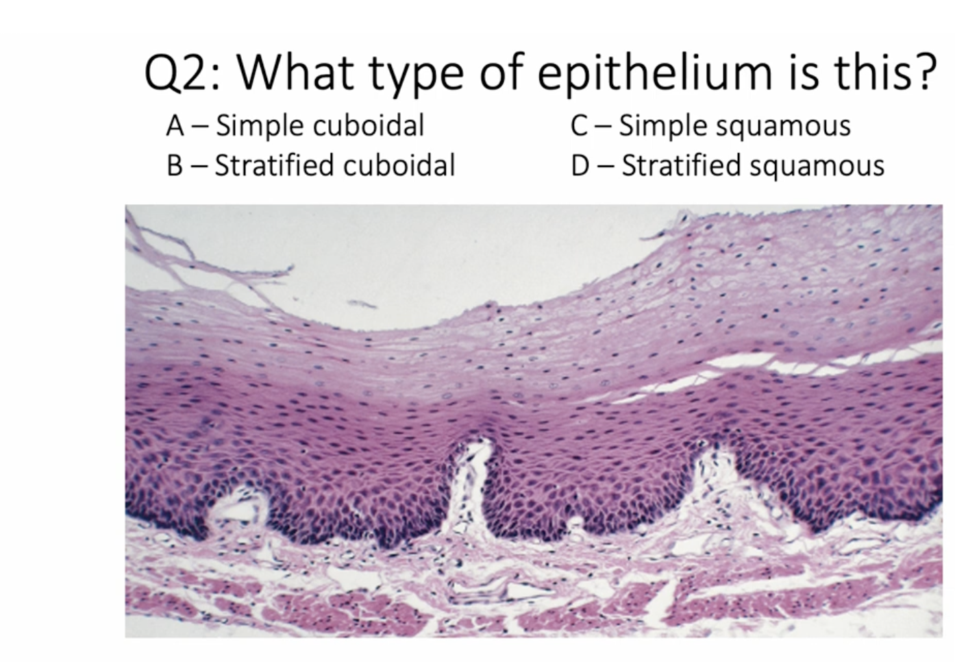 Solved What type of epithelium is this?A - ﻿Simple | Chegg.com