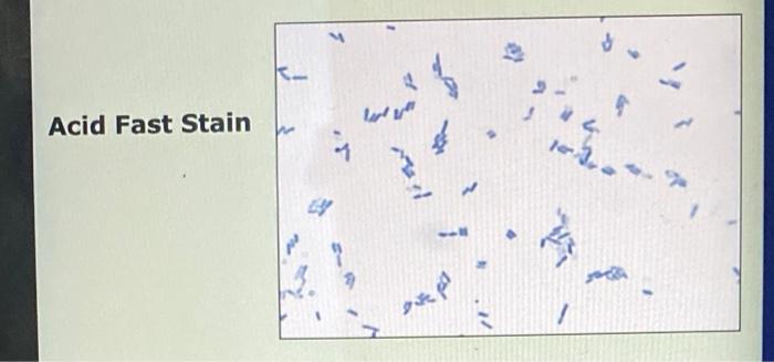 Solved a. is this organism acid fast positive or negativeb. | Chegg.com