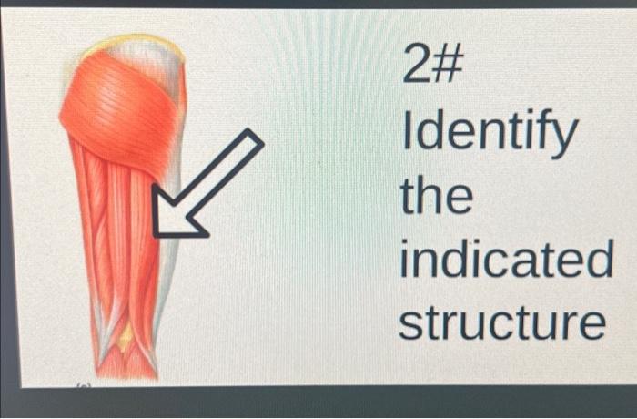 Solved 2\# Identify the indicated structure | Chegg.com