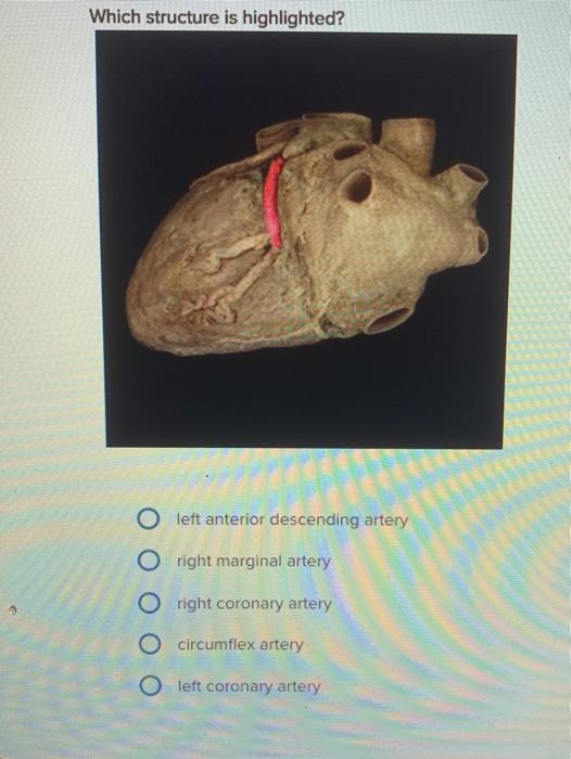 Solved Which structure is highlighted? O left anterior | Chegg.com