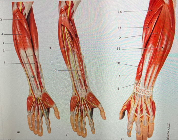 Solved label all the parts: a) superficial muscles, anterior | Chegg.com