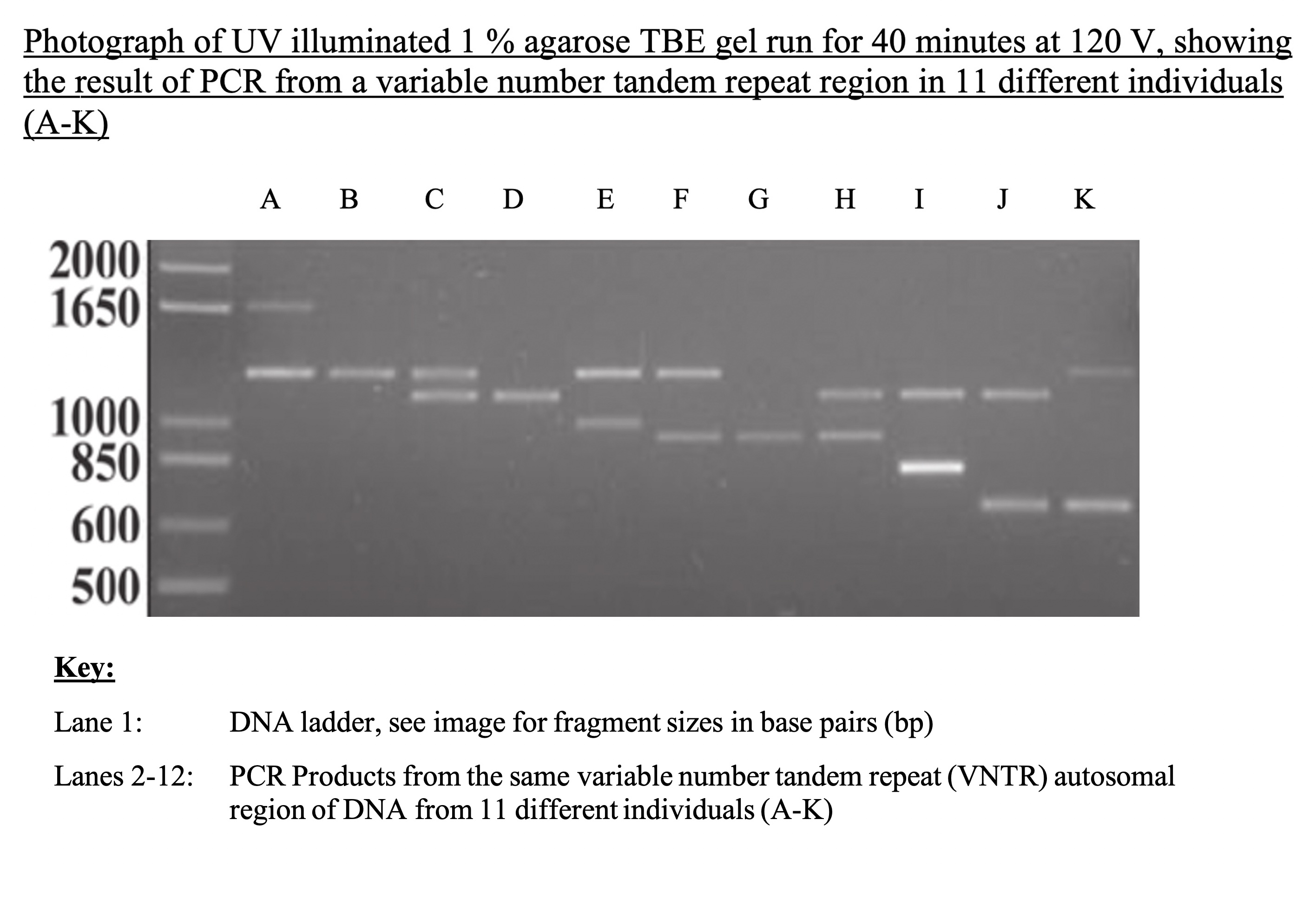 Solved Photograph of UV illuminated 1% ﻿agarose TBE gel run | Chegg.com