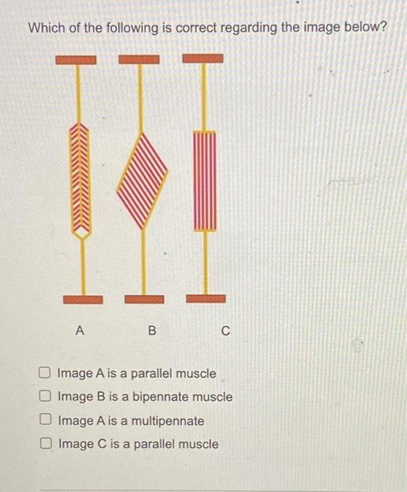 Solved Which of the following is correct regarding the image | Chegg.com