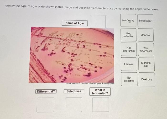 Solved Identify the type of agar plate shown in this image | Chegg.com