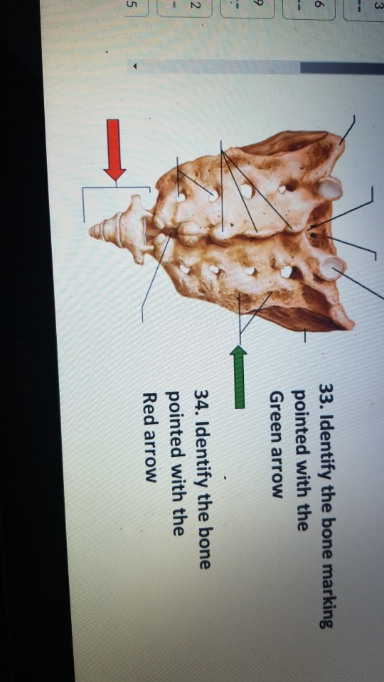 Solved QuCJIUN 2+1 pun) 32. Identify the structure pointed | Chegg.com